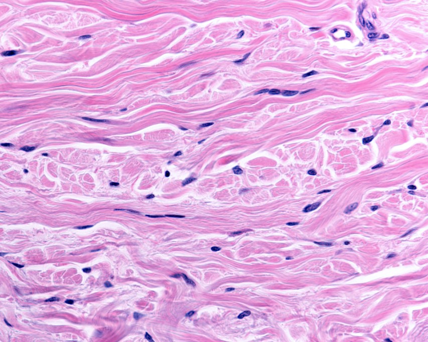 Des moyens naturels et simples pour réduire l’irritation cutanée ...